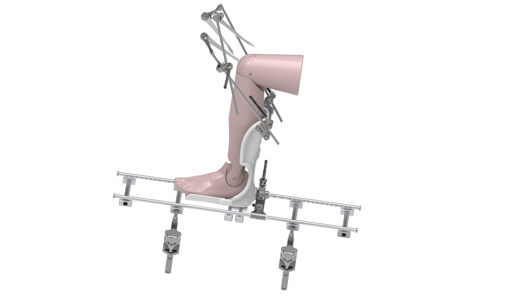 Condor Knee Positions - Knee Positioner in Knee Arthroplasty